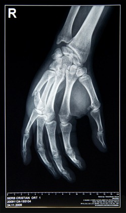 Radiografie